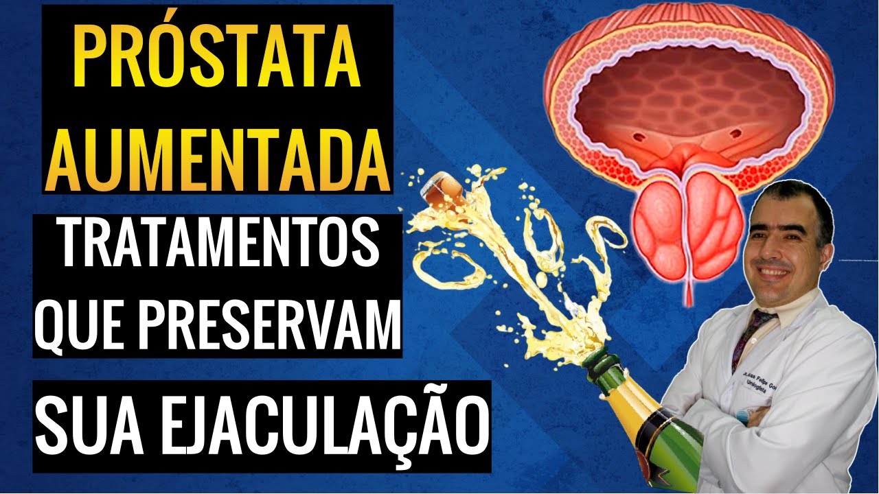 Tratamentos Para A Próstata Aumentada E Preservação Da Ejaculação Dr