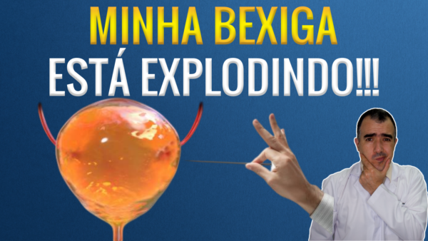 Sensação De Bexiga Cheia Dr Lucas Felipe Gomes Urologista