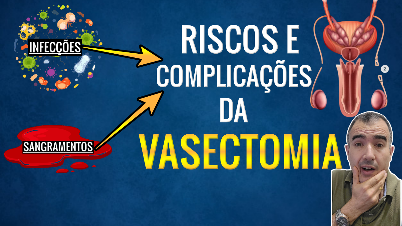 Riscos e complicações da vasectomia - Dr. Lucas Felipe Gomes - Urologista
